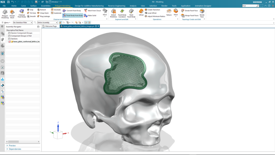 Digital Transformation for Medical Device Design - NX Design