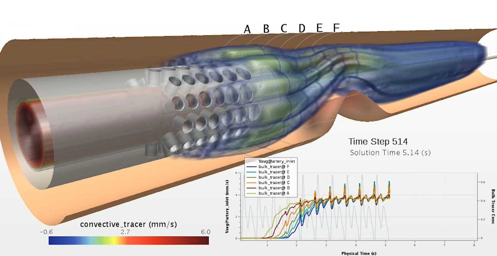 How to integrate simulation to enhance the medical device design ...