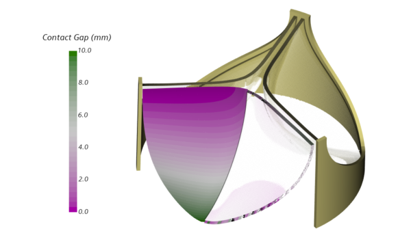 Fluid-structure interaction (FSI) of a Trileaflet Heart Valve - Simcenter