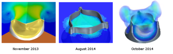 Fluid-structure interaction (FSI) of a Trileaflet Heart Valve - Simcenter